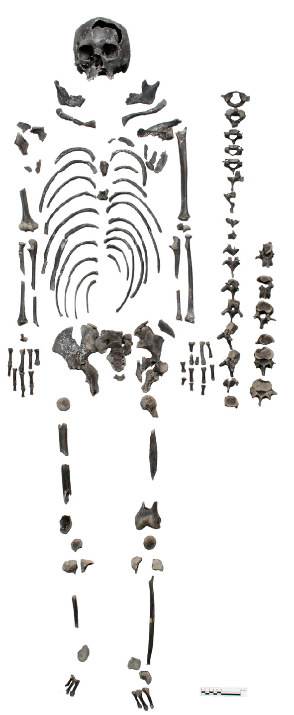Esqueleto El Hombre 2002