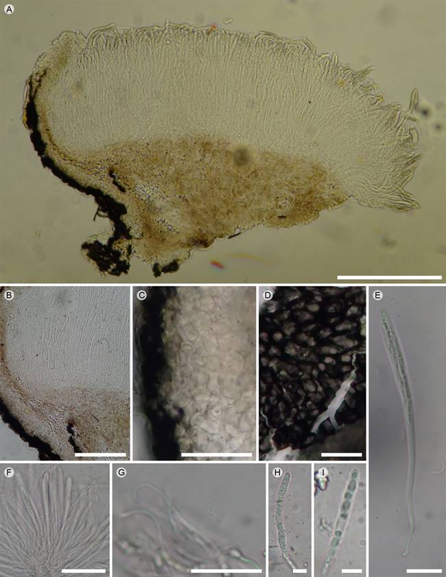 Nuevos registros de Coccomyces (Rhytismatales, Ascomycota) para México