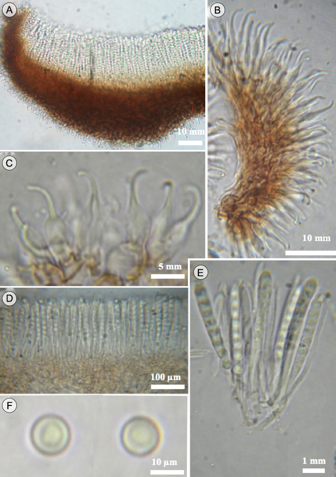 Primer registro de Unguiculariopsis ravenelii (Leotiomycetes ...