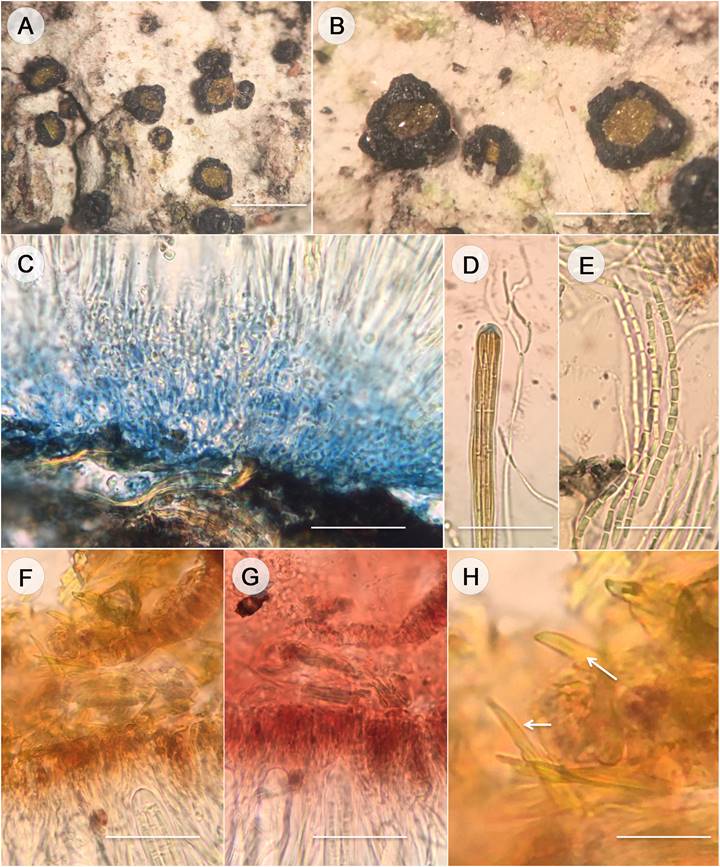 Bactrospora totonacae (Arthoniales, Ascomycota), a new species from ...