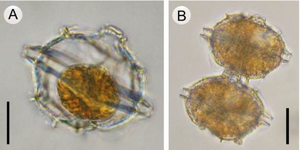 Reconocimiento de dos variedades taxonómicas de Pyrodinium bahamense ...