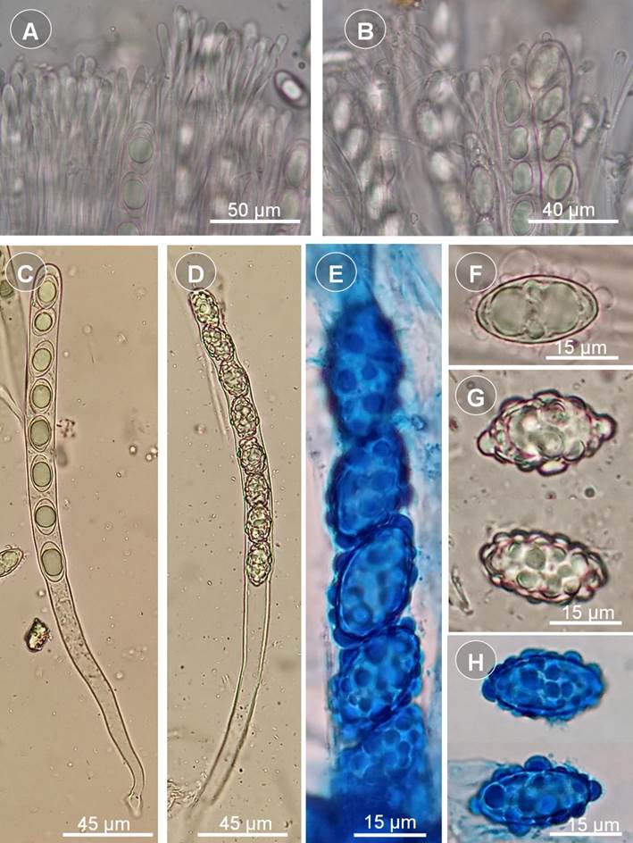 Primer registro de Trichophaeopsis paludosa (Pyronemataceae, Ascomycota ...