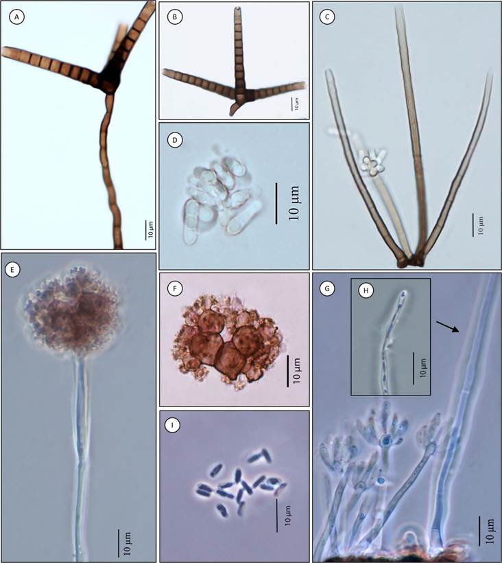 Micromicetos asexuales hallados sobre hojas de Quercus spp. (Fagaceae ...