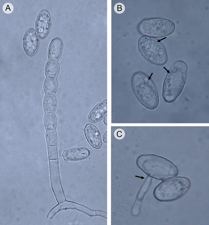 Identificación molecular de los tipos de compatibilidad en poblaciones ...