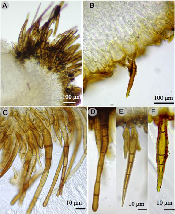 Humaria setimarginata (Pyronemataceae, Ascomycota), a new species from ...