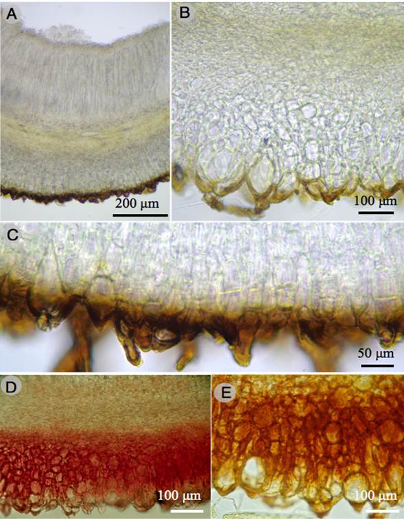 Humaria setimarginata (Pyronemataceae, Ascomycota), a new species from ...