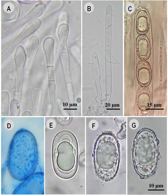Humaria setimarginata (Pyronemataceae, Ascomycota), a new species from ...