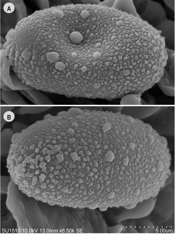 Humaria setimarginata (Pyronemataceae, Ascomycota), a new species from ...