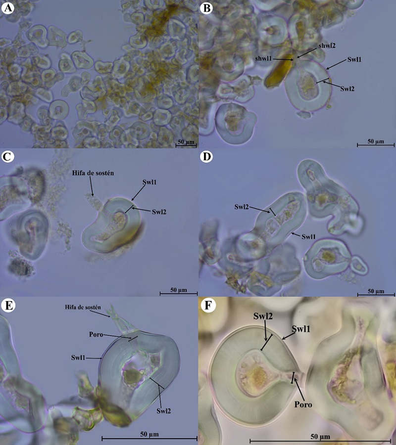 Glomus nanolumen (Glomeraceae), un hongo micorrízico arbuscular en México