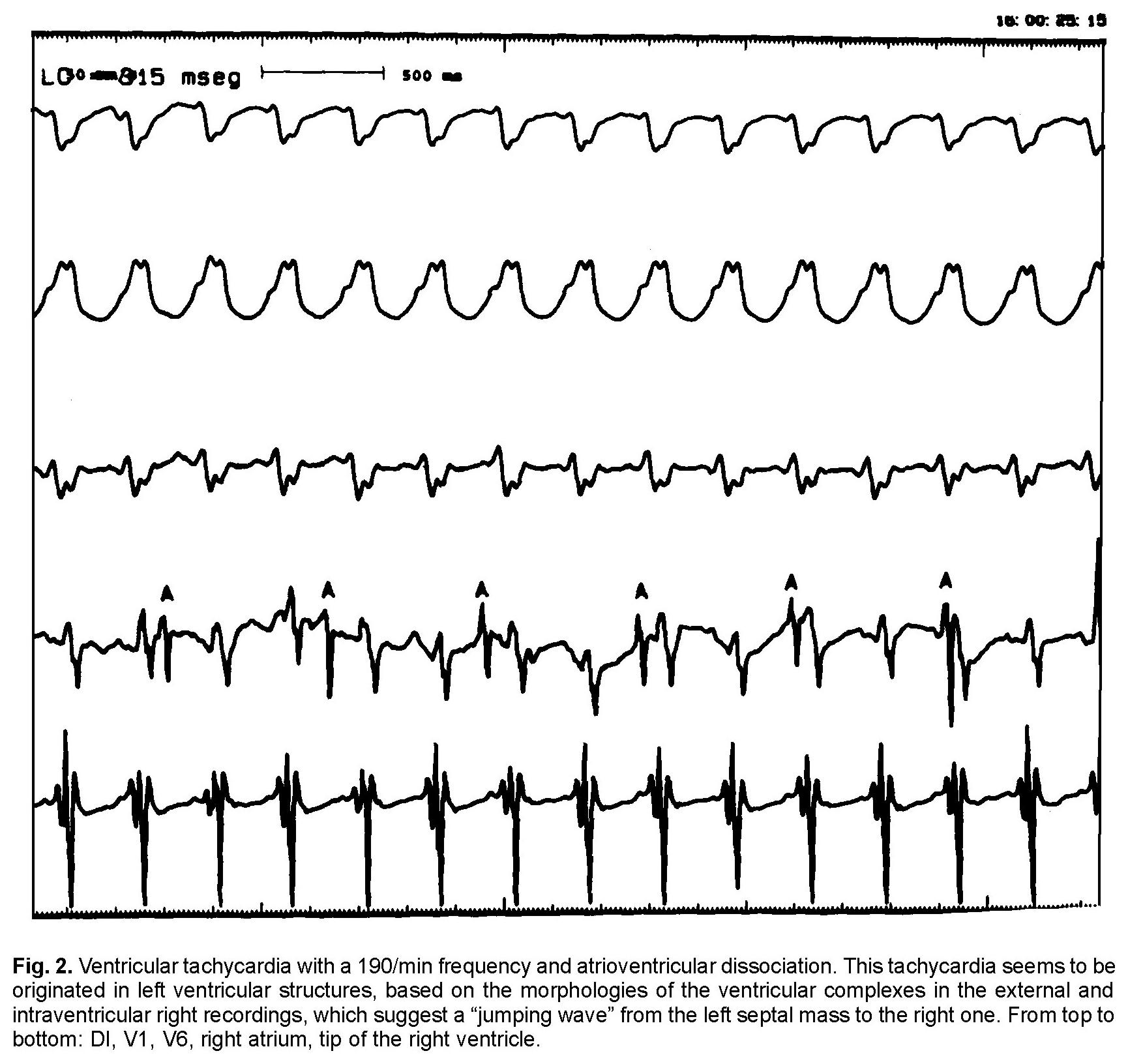 The rational approach to the electrical exploration of the heart