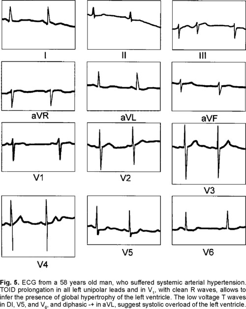 The rational approach to the electrical exploration of the heart