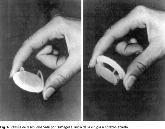 50 aniversario de la implantación de la primera válvula aórtica