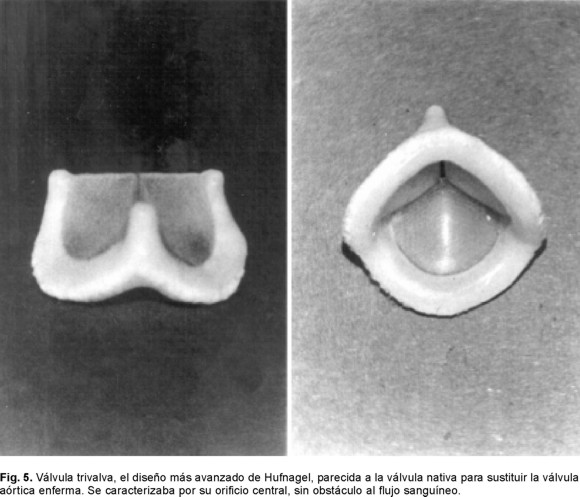 50 aniversario de la implantación de la primera válvula aórtica