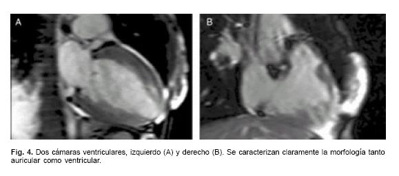 Aplicación del método de resonancia magnética cardiovascular en el ...