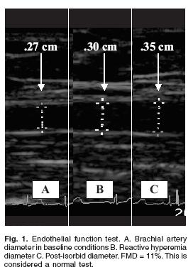 Non-invasive assessment of endothelial function. Intra and inter ...