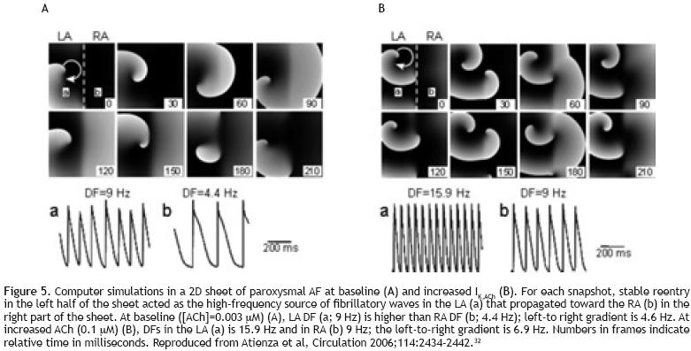 Ionic and substrate mechanisms of atrial fibrillation: rotors and the ...