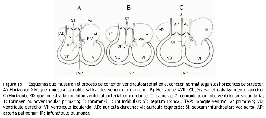 Doble salida de ventrículo derecho: Enfoque embriológico