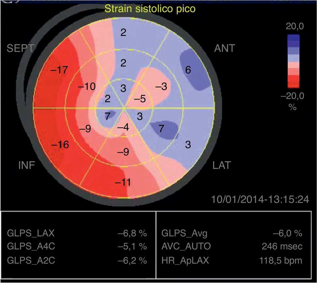 Deformación sistólica longitudinal del ventrículo izquierdo en ...