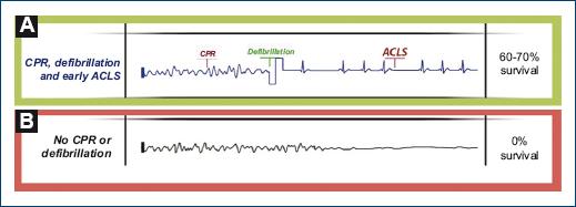 Current behavior of sudden cardiac arrest and sudden death