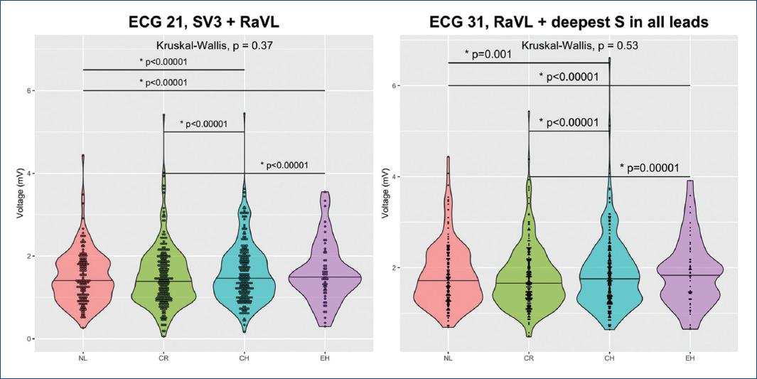Diagnostic utility of 31 ECG criteria for predicting echocardiographic ...