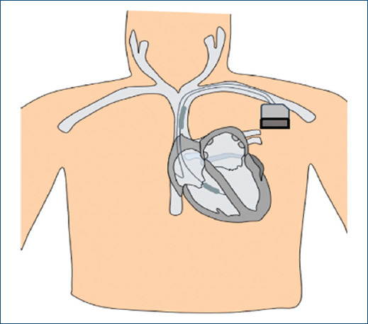 Guía para identificar características específicas en dispositivos de ...