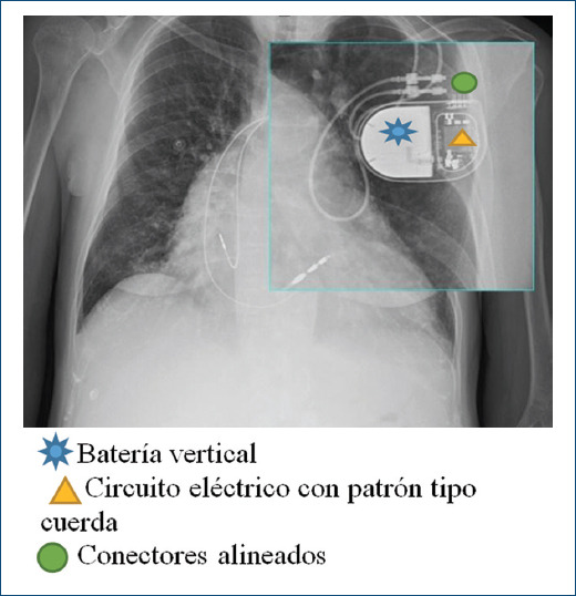 Guía para identificar características específicas en dispositivos de ...
