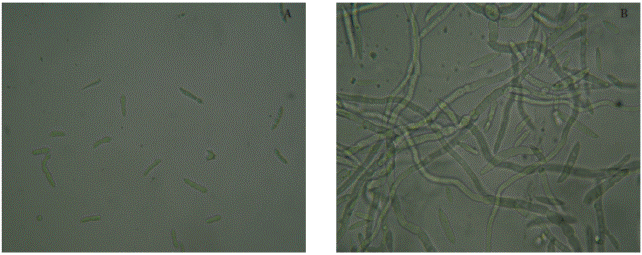 Actividad in vitro de Bacillus spp. en la inhibición de crecimiento ...