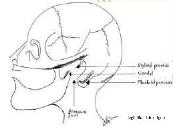 Update on the Management of Laryngospasm