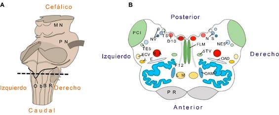 Síndrome de Wallenberg: correlación neuroanatómica