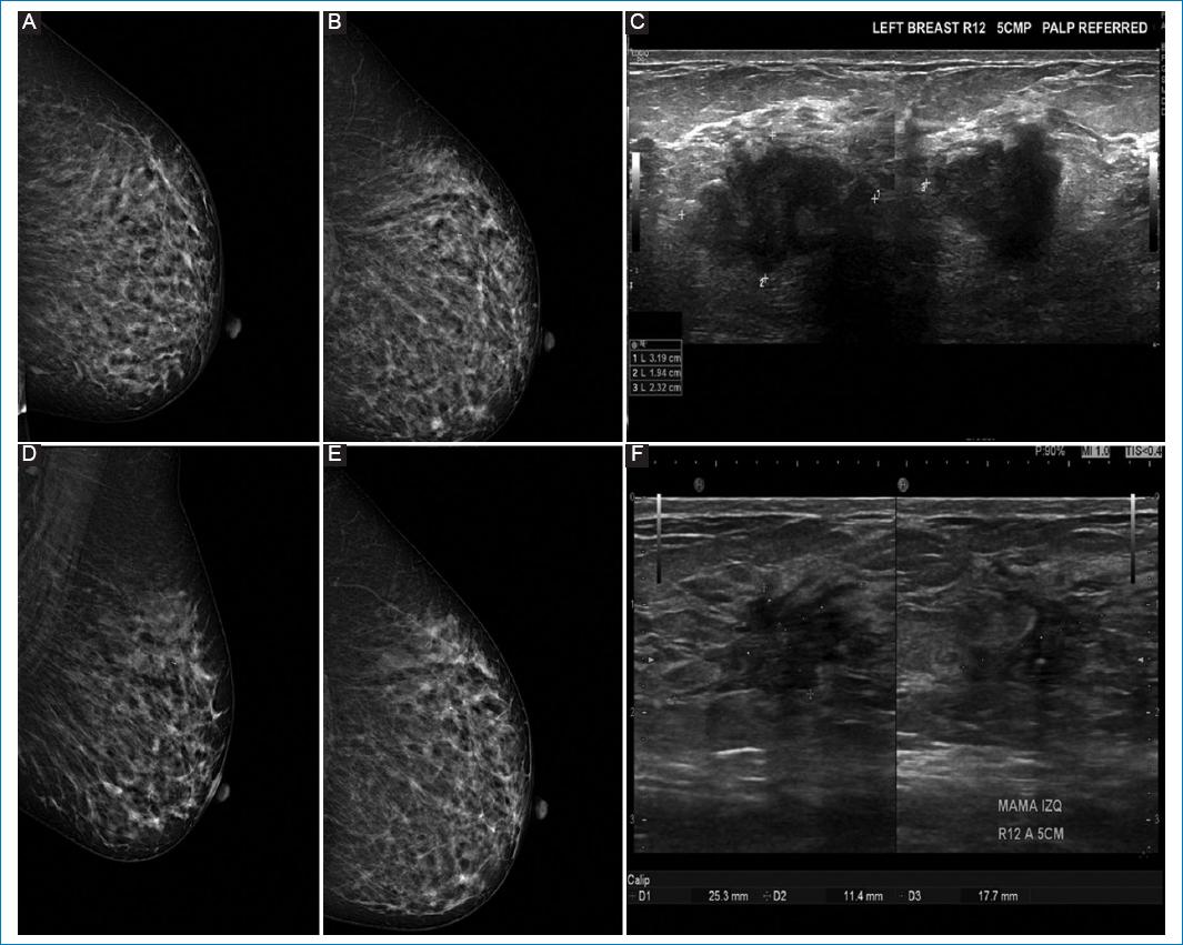 Radio-pathological agreement of conventional imaging studies to ...