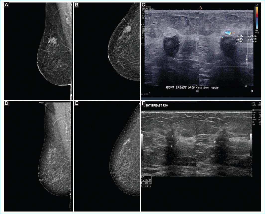Radio-pathological agreement of conventional imaging studies to ...