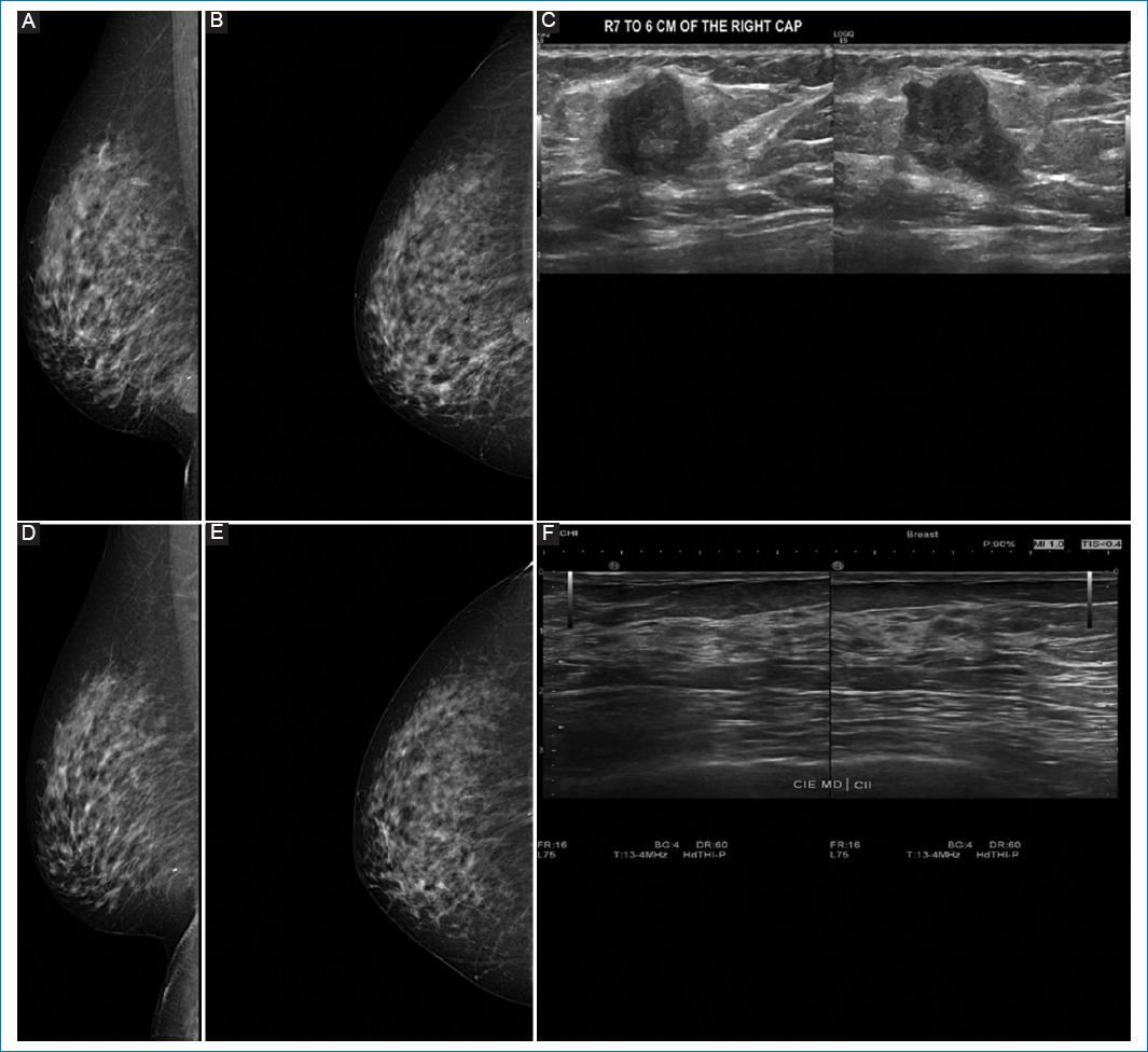 Radio-pathological agreement of conventional imaging studies to ...