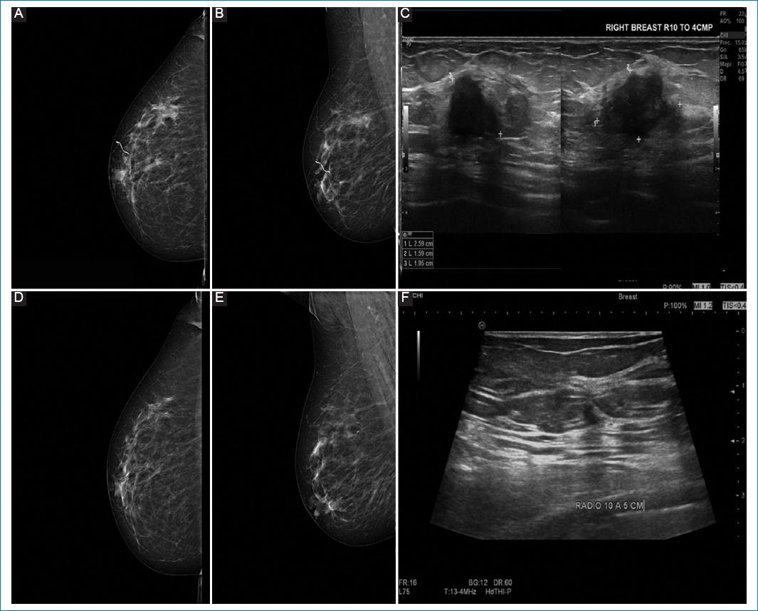 Radio-pathological agreement of conventional imaging studies to ...