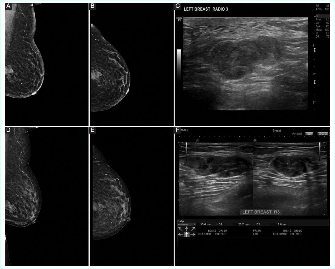 Radio-pathological agreement of conventional imaging studies to ...