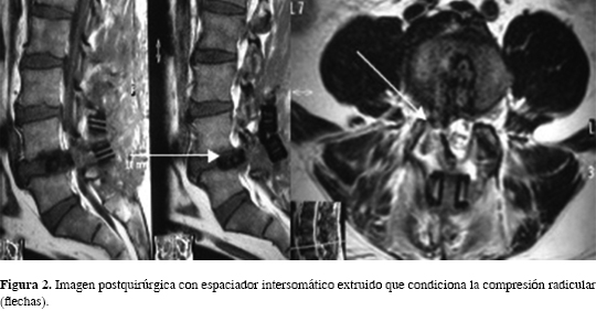 Síndrome de Forestier: Reporte de un caso y revisión de la literatura