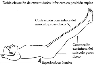 Signo Del Psoas