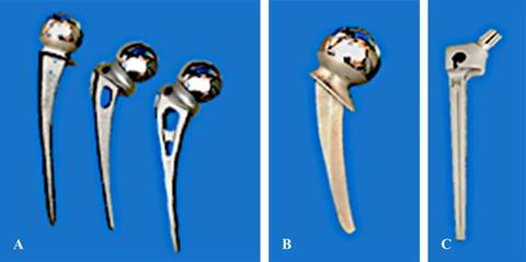 Historia y desarrollo de la artroplastía de cadera. Una visión de sus ...