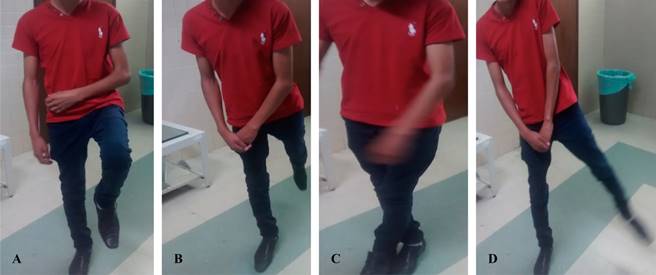 Evaluación clínica y funcional de pacientes pediátricos con fractura de ...