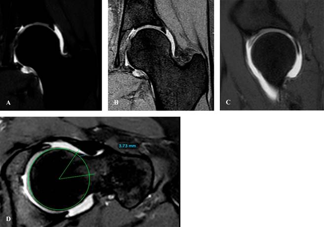 Evaluación sistemática de la cadera dolorosa