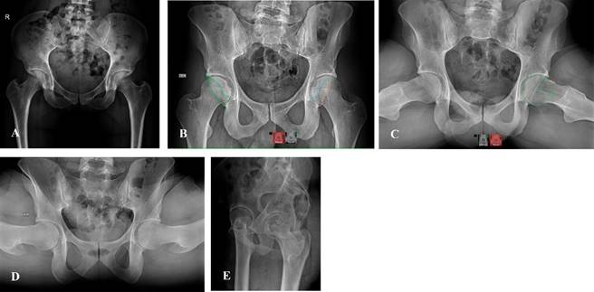 Evaluación sistemática de la cadera dolorosa
