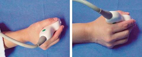 Ergonomics to perform thoracic limb musculoskeletal ultrasound