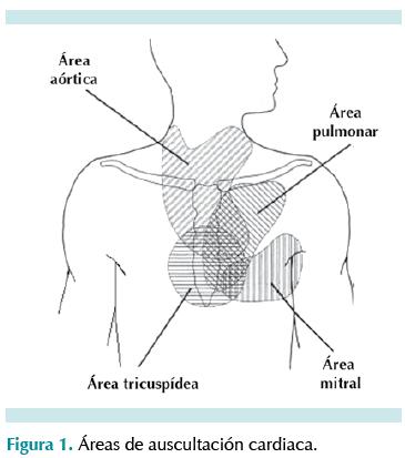 Soplos cardiacos en pediatría: cuándo referir al cardiólogo pediatra