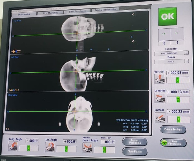 Desarrollo de un protocolo de control de calidad para el sistema de ...