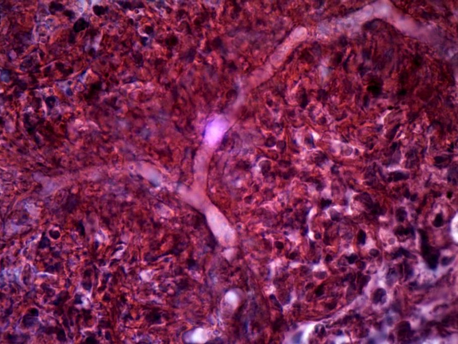 Inmunoterapia y manejo quirúrgico de Pythium insidiosum en un equino ...