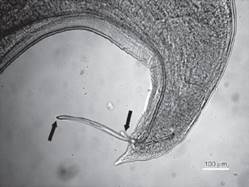 Proventricular parasitosis by Procyrnea sp. (Spiruroidea ...