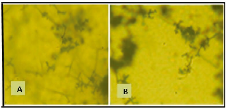 Isolation and characterization of one autochthonous Beauveria sp ...