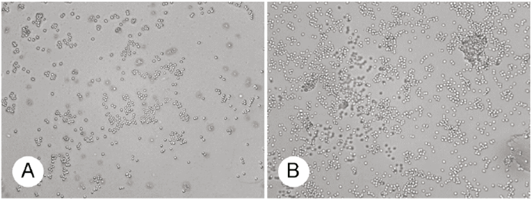 Isolation and characterization of one autochthonous Beauveria sp ...
