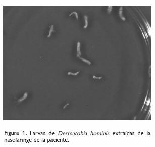 Miasis de nasofaringe, completando ciclo biológico in vitro