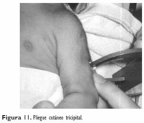 Mediciones antropométricas en el neonato
