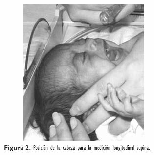 Mediciones antropométricas en el neonato